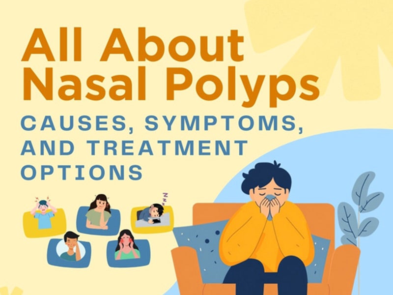 Causes, Symptoms, and Treatments of Nasal Polyps